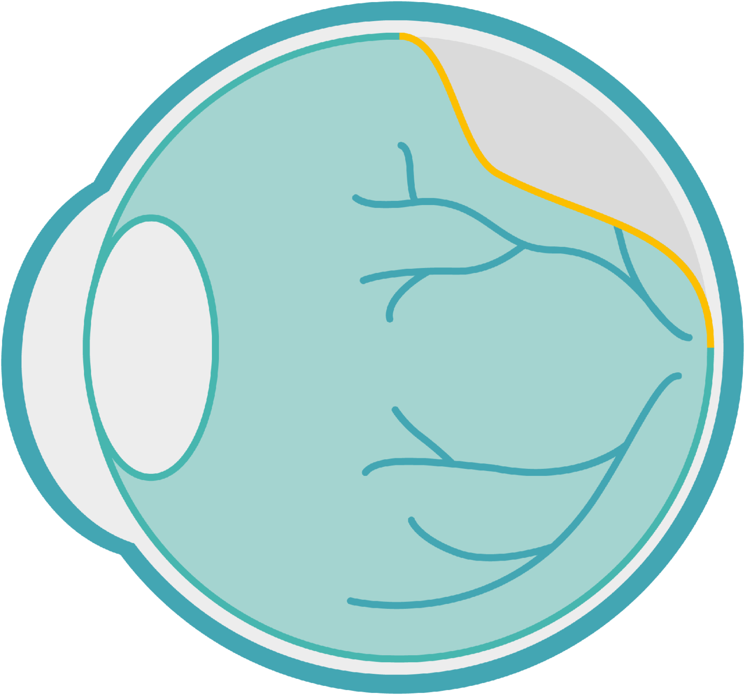 Netzhautrisse und Netzhautablösungen | Dr. Seidel